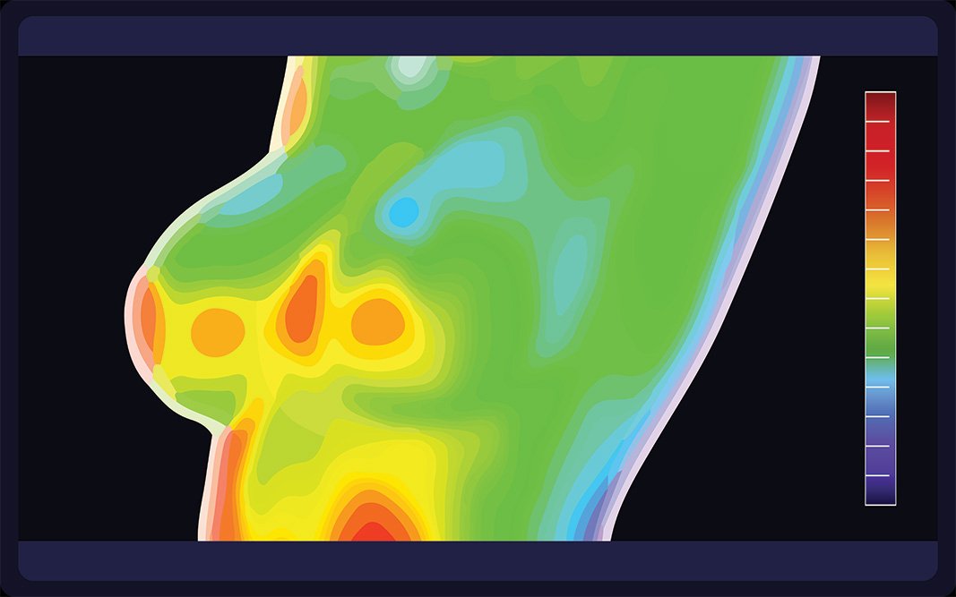 Breast Thermography: Technology, Benefits, and Cancer Signs - Wellness ...